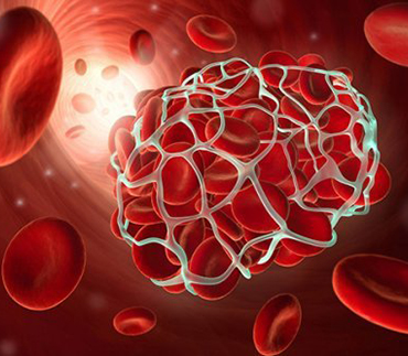 Oropharynxkarzinom Symptome Die Jeder Kennen Sollte